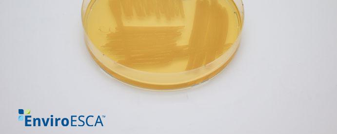 EnviroESCA - XPS surface studies of bacteria and biofilms under near ambient pressure conditions ...